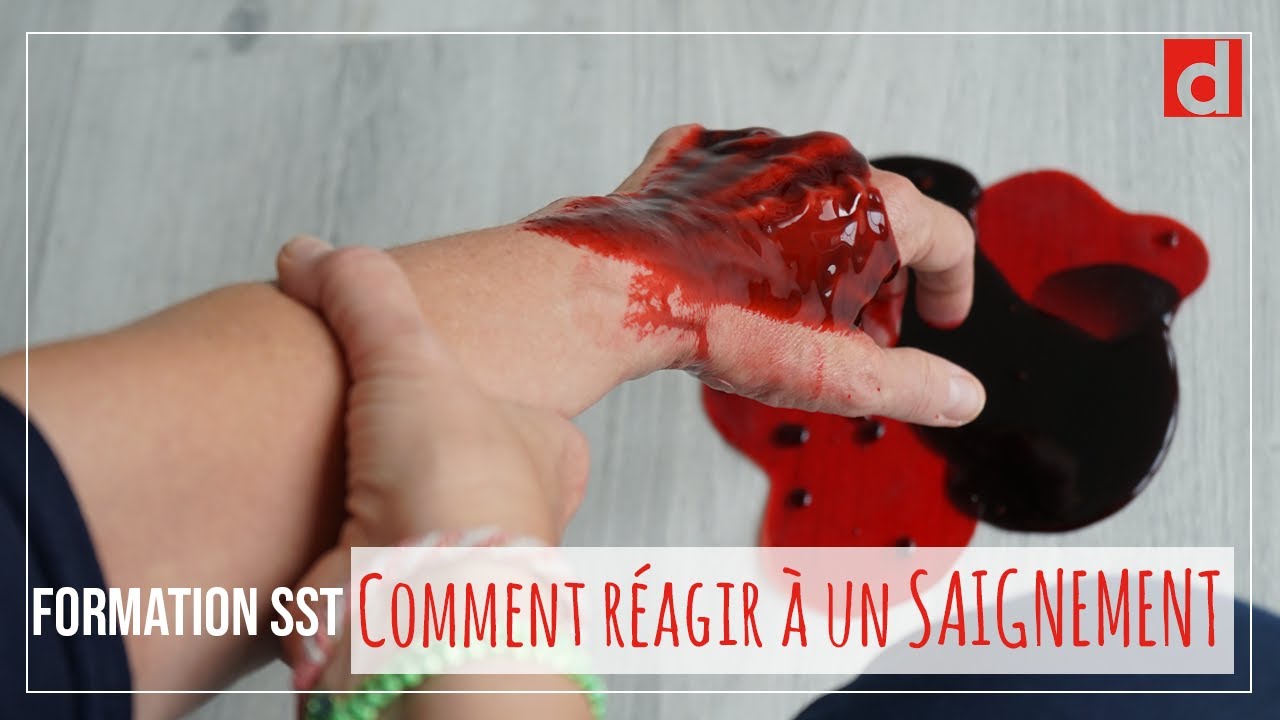 Comment réagir à un saignement ? - Academie Avec